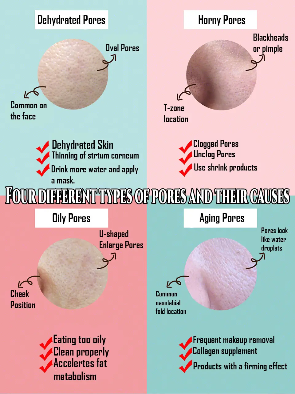 Four different types of pores and their causes💜 | Gallery posted by A.G ...