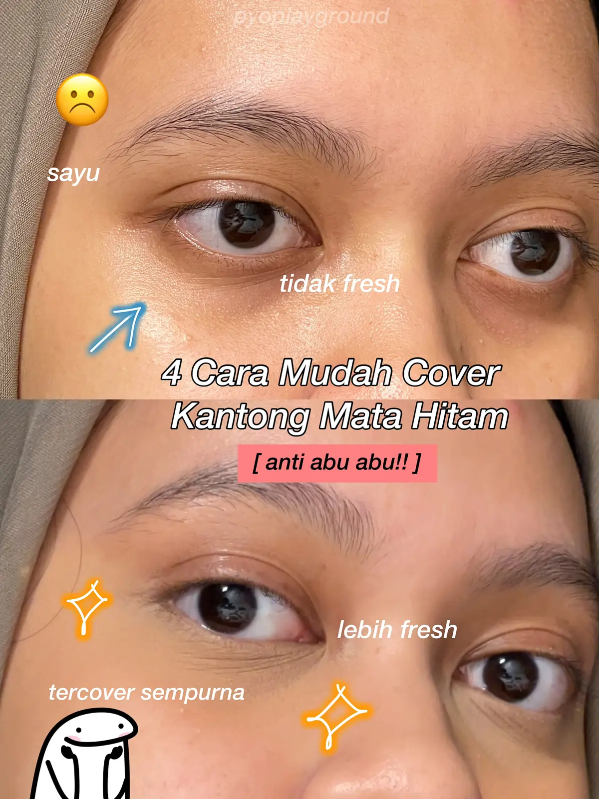 4 Tips Untuk Menutupi Kantong Mata Hitam‼️ | Galeri diposting oleh ...