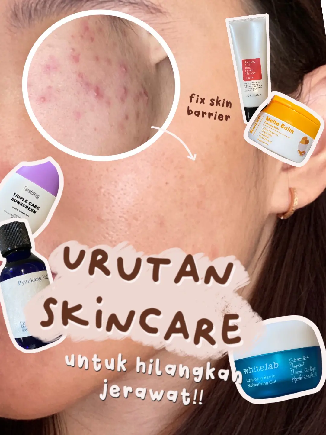 Kulit Bebas Jerawat dengan Skincare Routine ini! | Galeri diposting ...