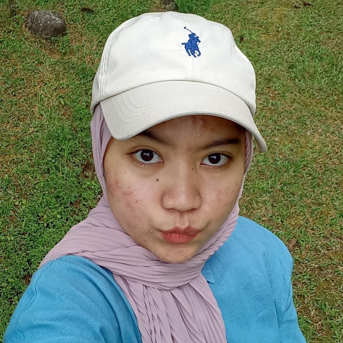 Posting Indah | acne🧚‍|Lemon8