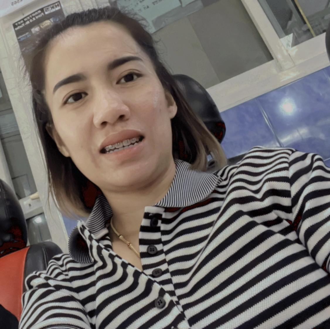 โพสต์ ของ Num|Lemon8