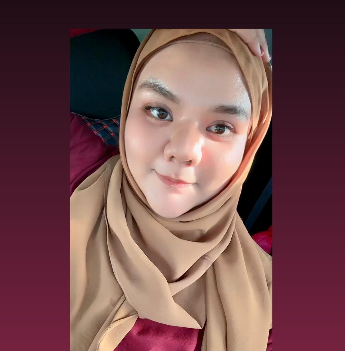 Siarkan Dolphine Cute|Lemon8