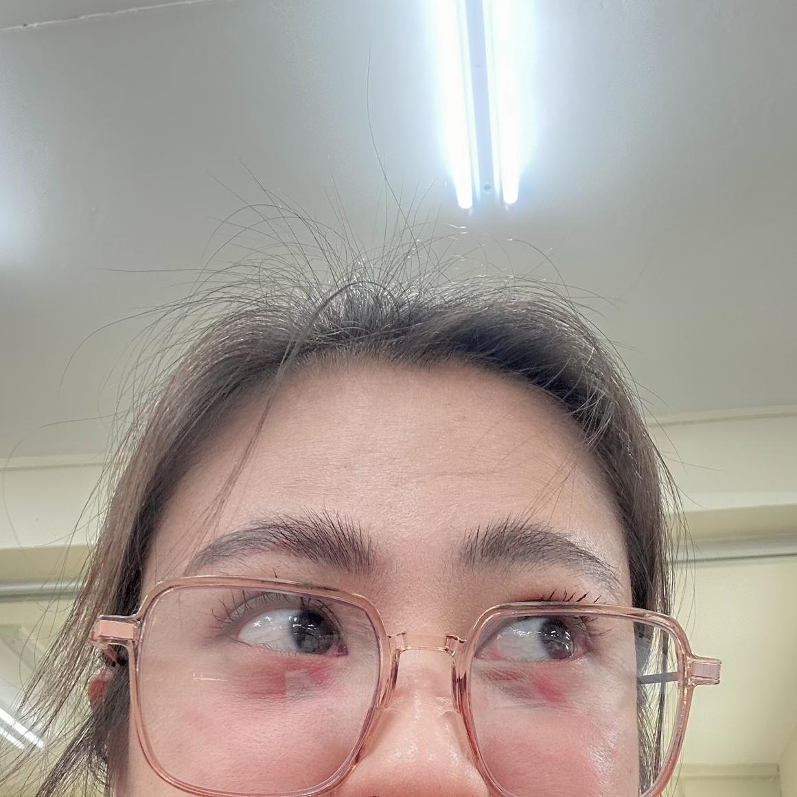 โพสต์ ของ TN|Lemon8