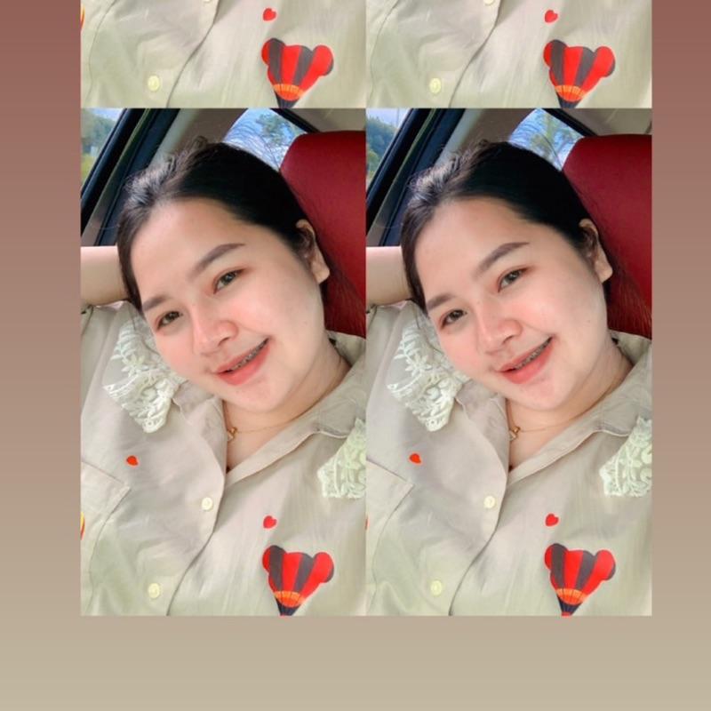 โพสต์ ของ W.|Lemon8