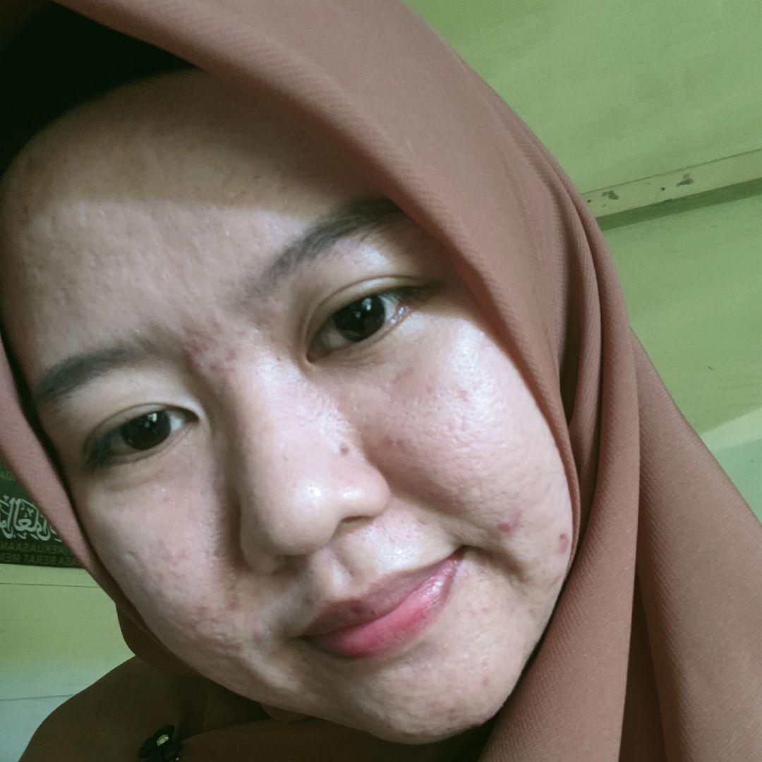 โพสต์ ของ Aulia Azizah|Lemon8