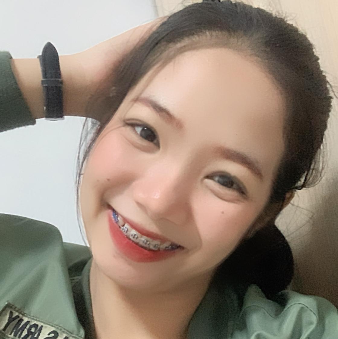 โพสต์ ของ Admin bee532|Lemon8