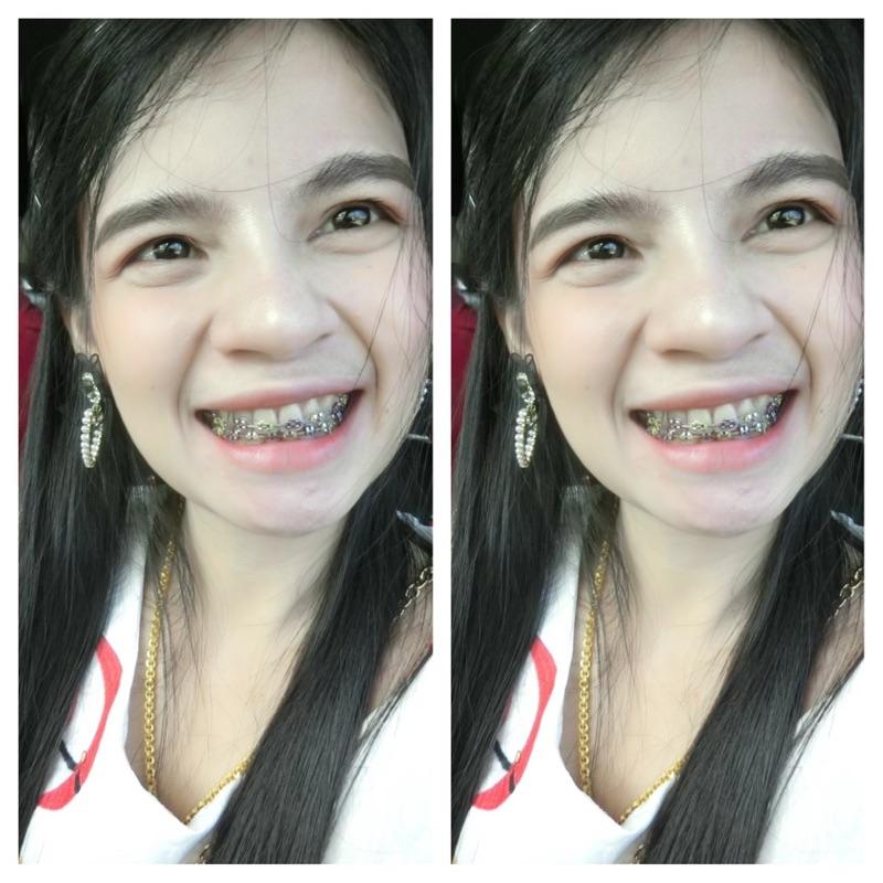 โพสต์ ของ 😘BENJARAT🥝🥕🥦|Lemon8