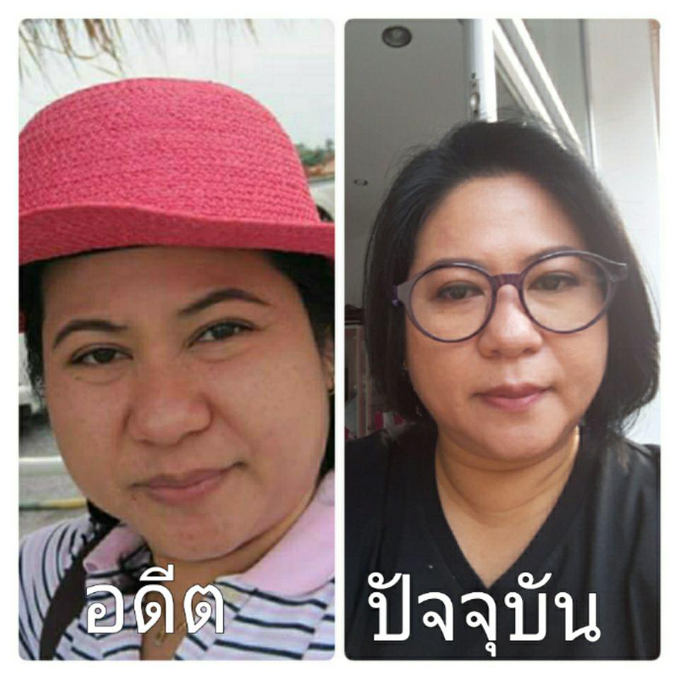 โพสต์ ของ JUB@สบายหน้า|Lemon8