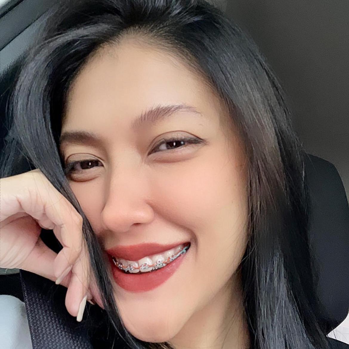 โพสต์ ของ mild ♡|Lemon8