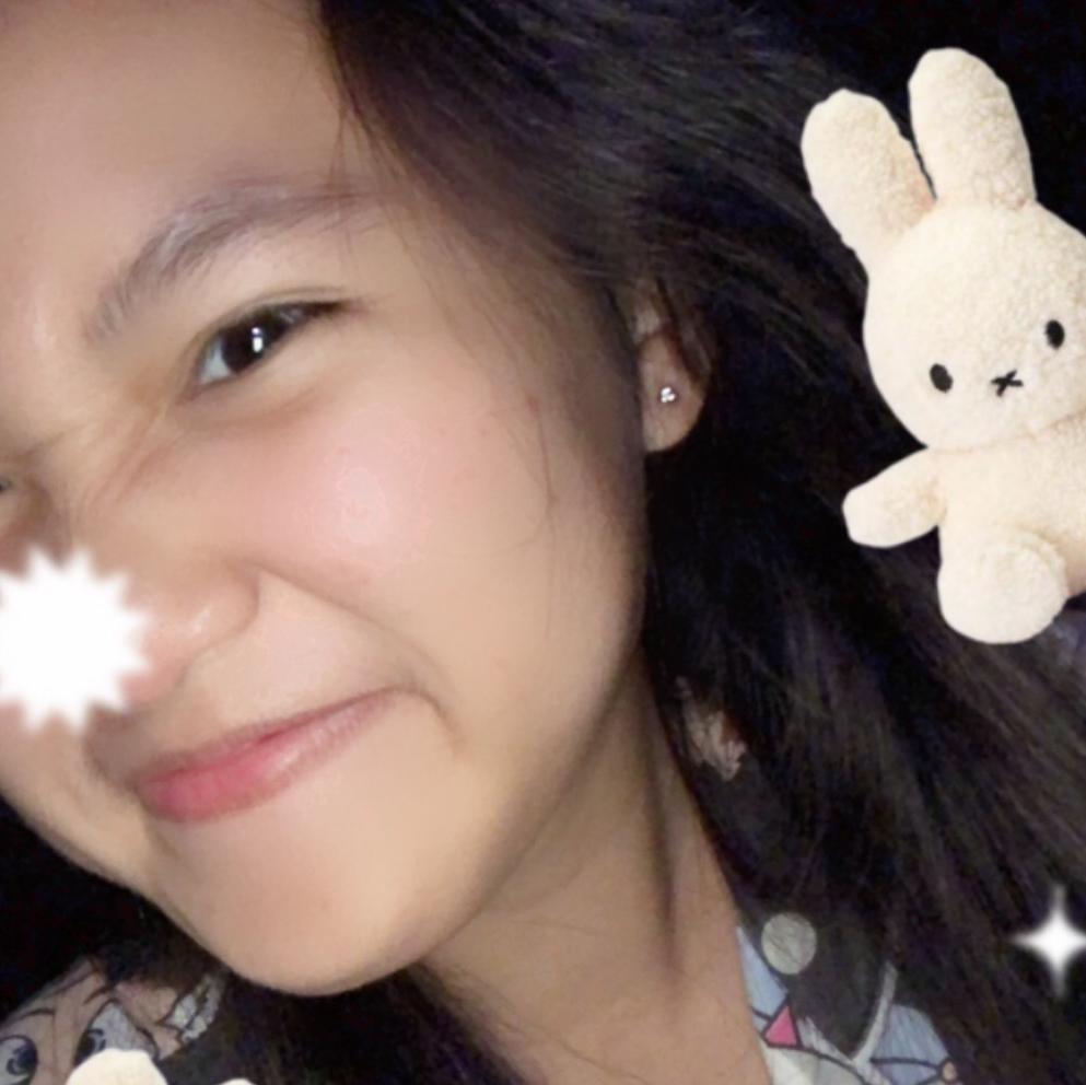 โพสต์ ของ Myname’s EA RN|Lemon8