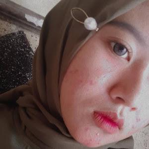 โพสต์ ของ Shelva Reza|Lemon8