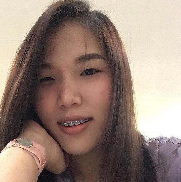 โพสต์ ของ Mild|Lemon8