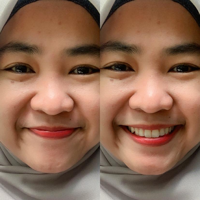 Posting Eka Suhardini|Lemon8