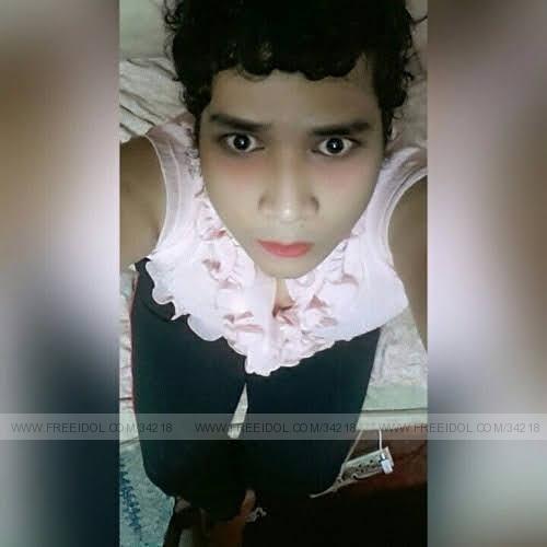 โพสต์ ของ DOWN SYNDROME|Lemon8