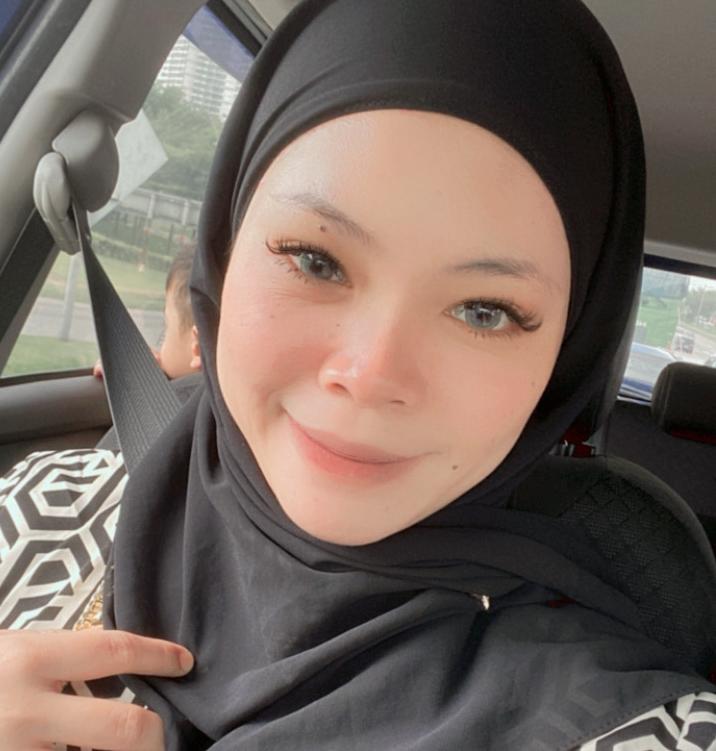 Siarkan 𝚁𝚒𝚗𝚊𝚊𝚊𝚊|Lemon8