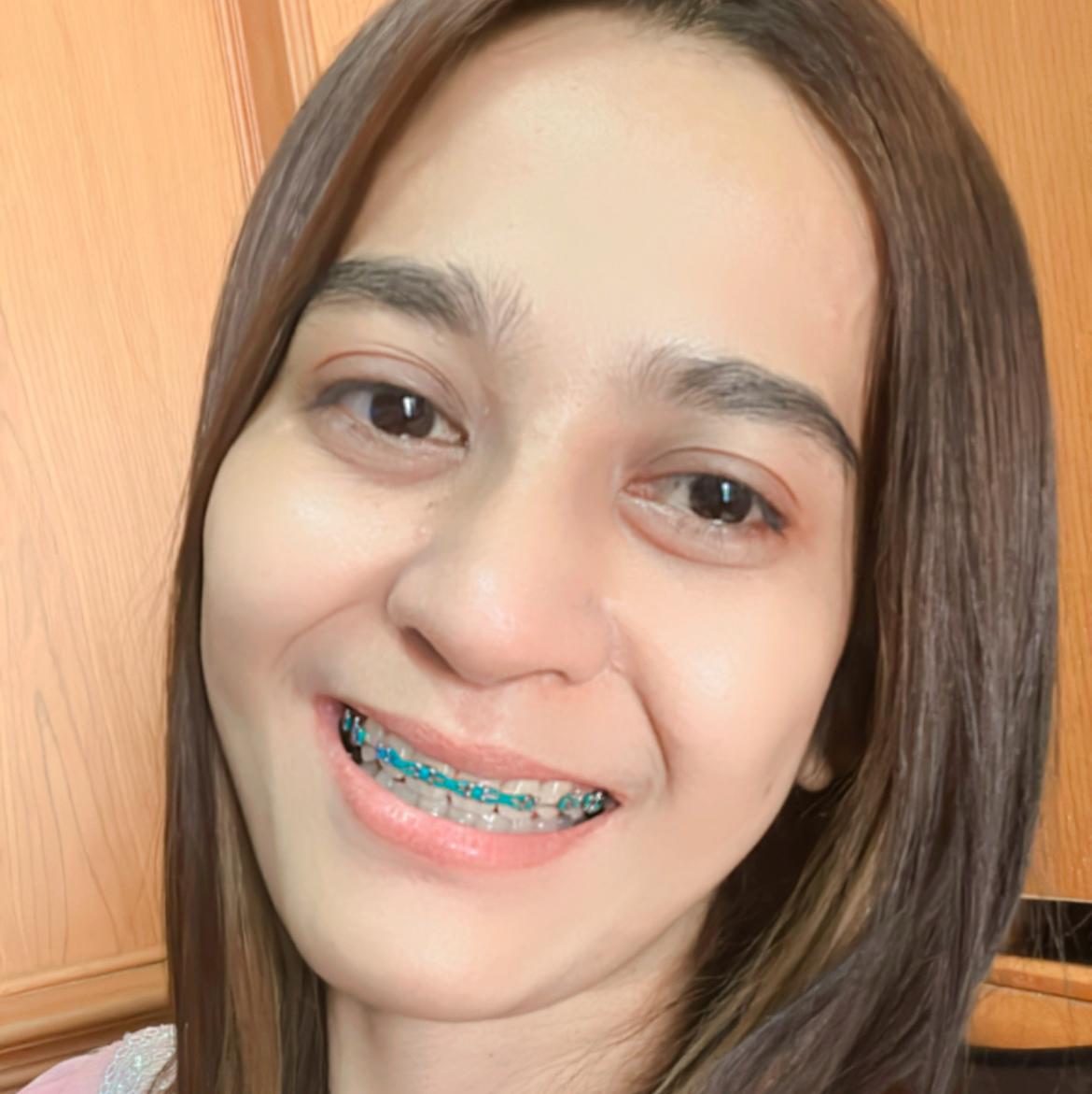 โพสต์ ของ Annie|Lemon8