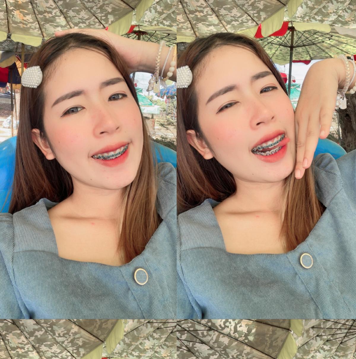 โพสต์ ของ Pure 14 :)|Lemon8