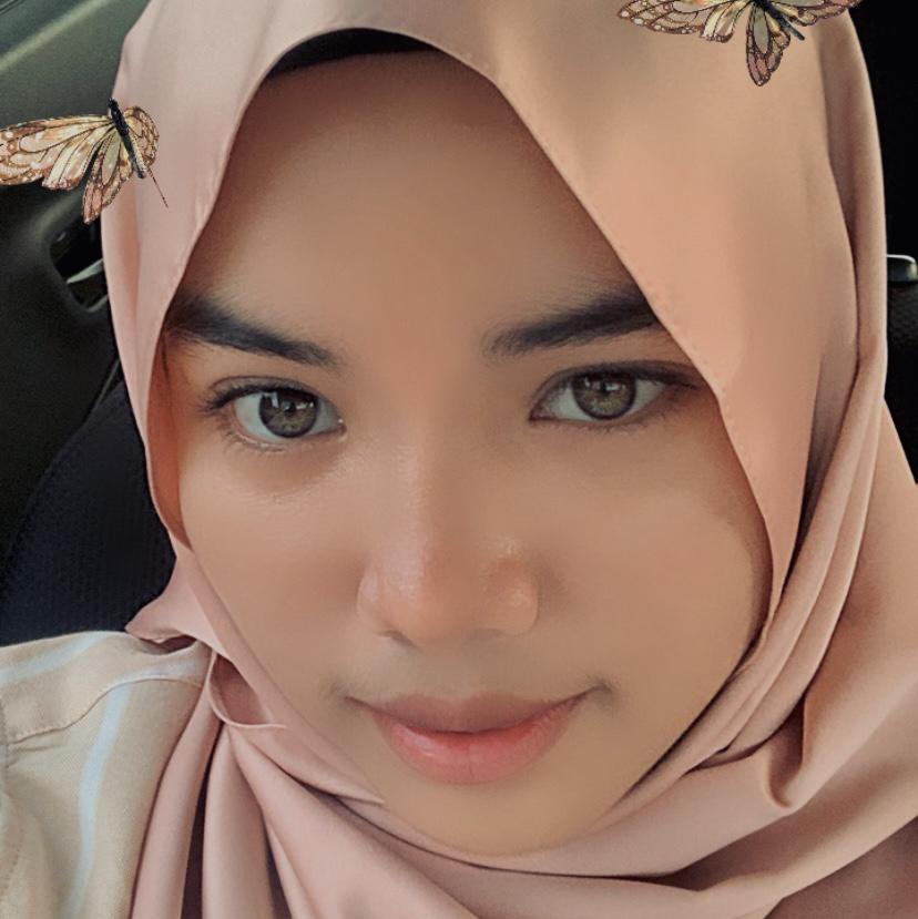 โพสต์ ของ Ally|Lemon8