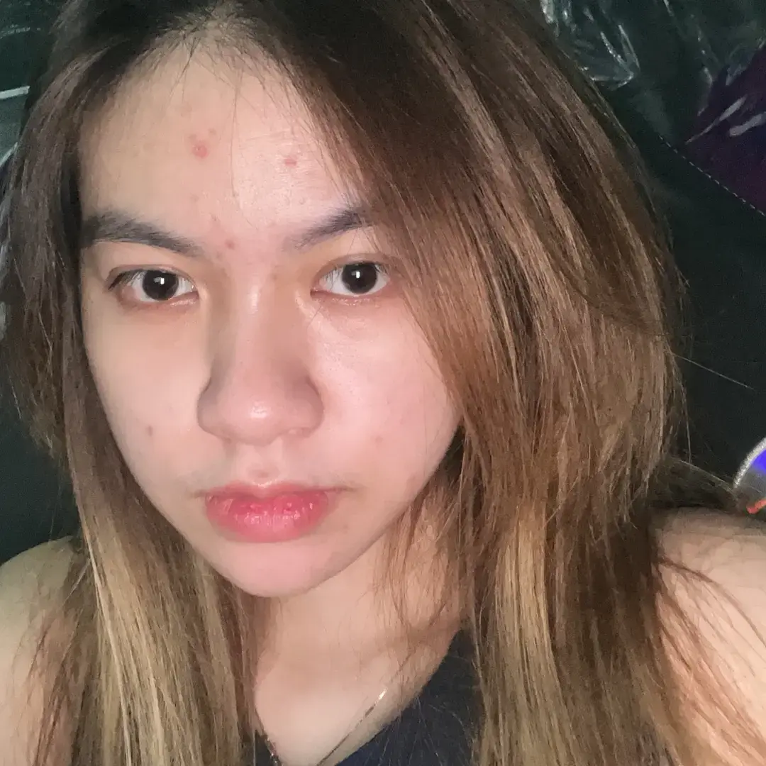 Posting 🦄🦋anggi|Lemon8