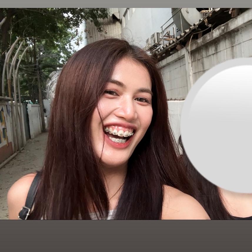 โพสต์ ของ NN|Lemon8