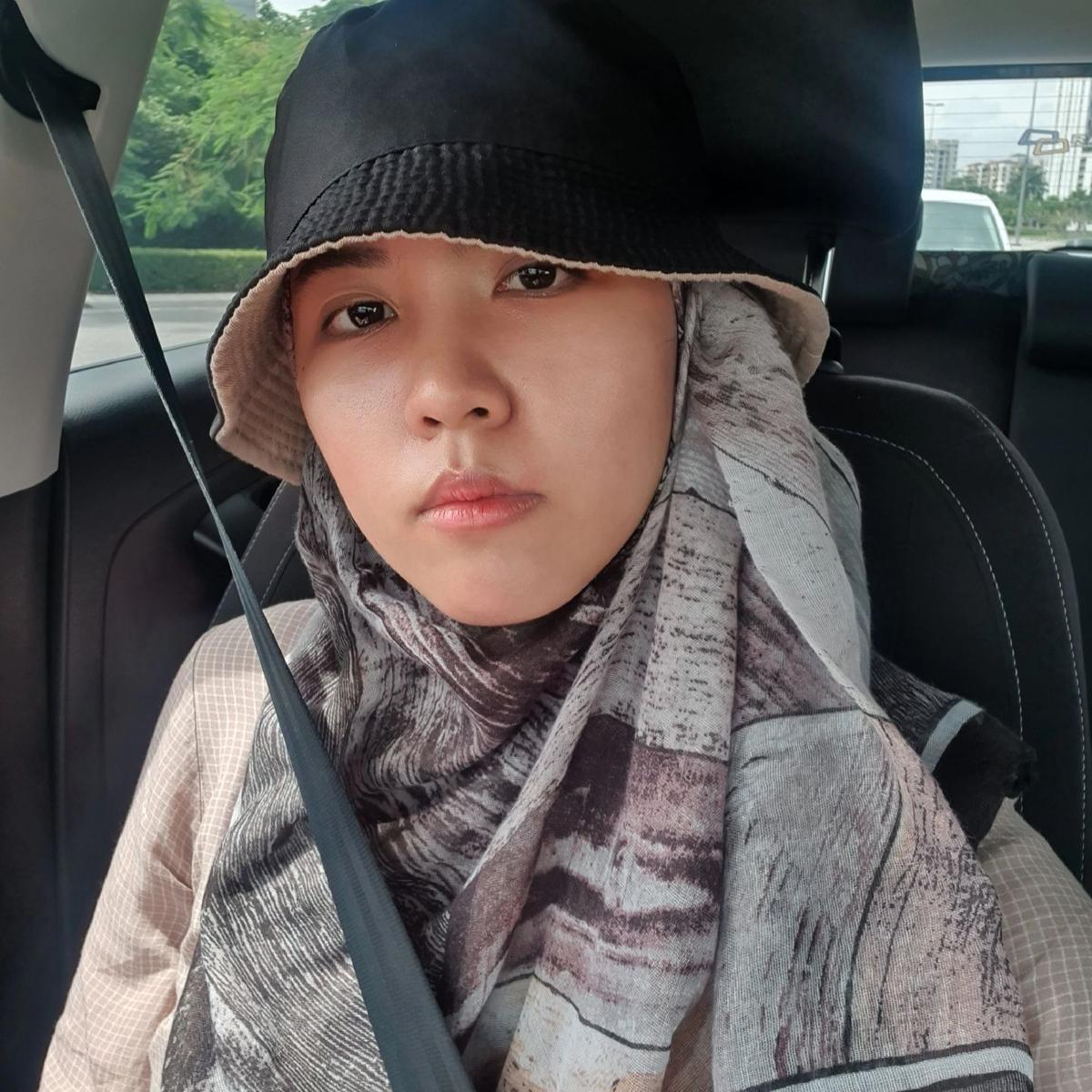 Siarkan Sis Cuba Try|Lemon8