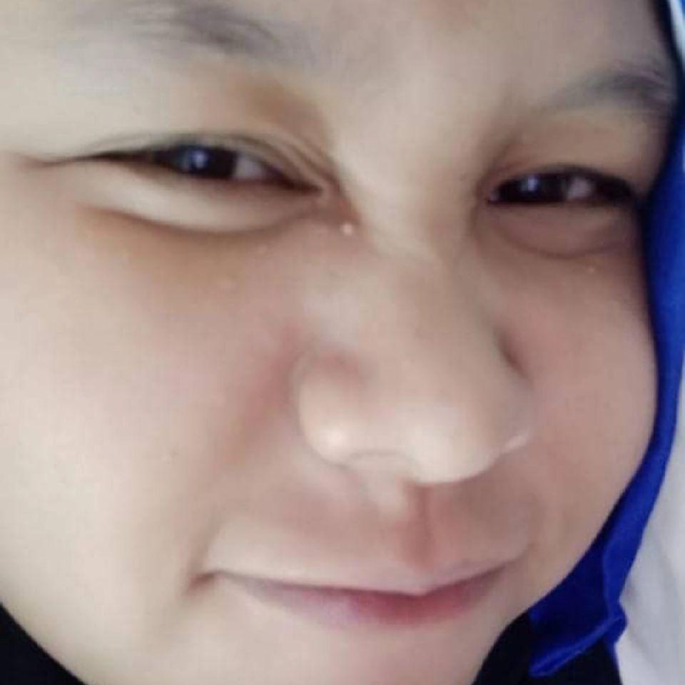 Siarkan alliXa|Lemon8