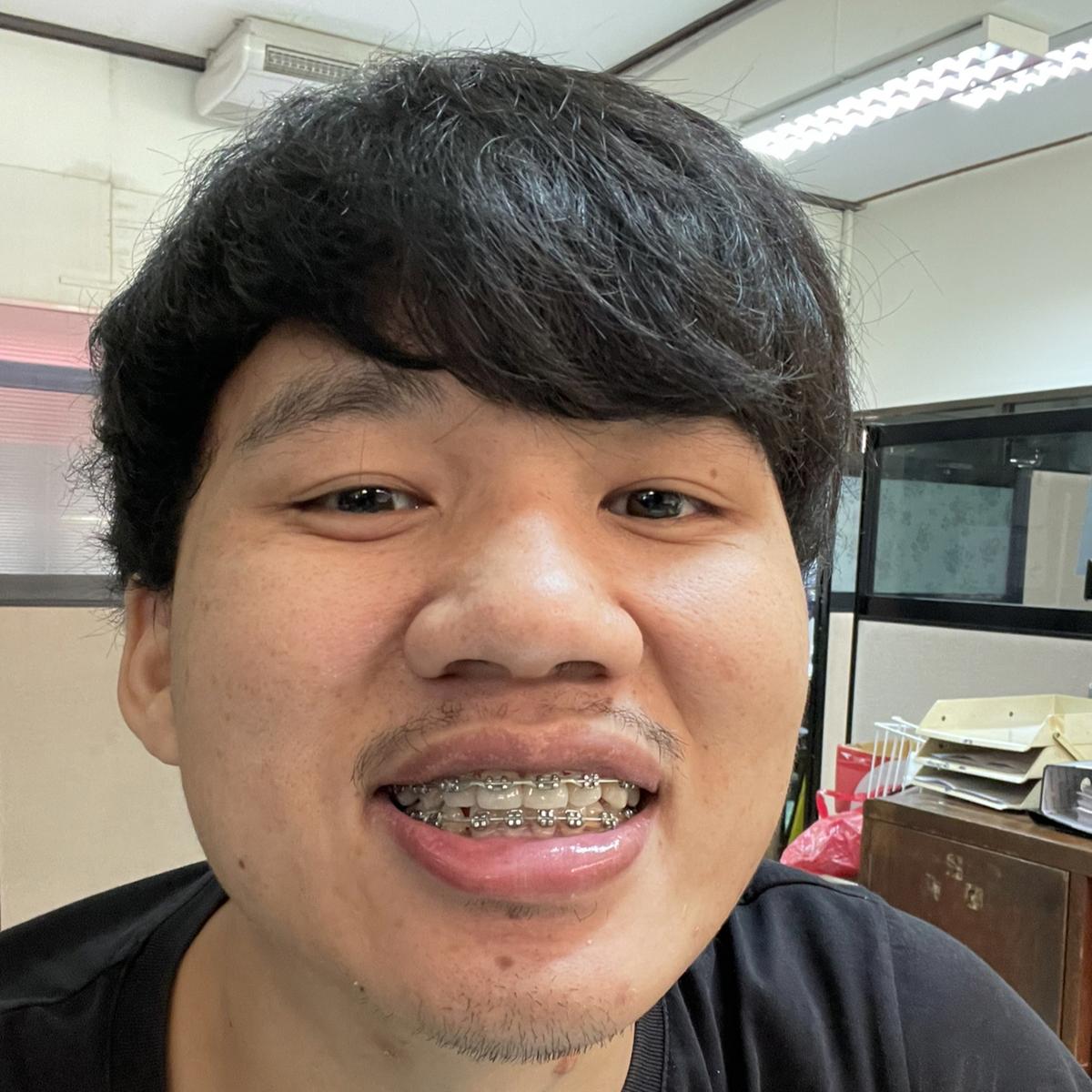 โพสต์ ของ JJ 17|Lemon8