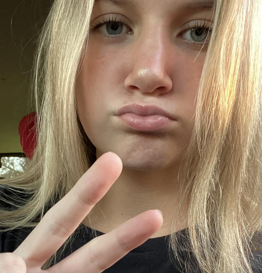 โพสต์ ของ Lakyn🎀|Lemon8