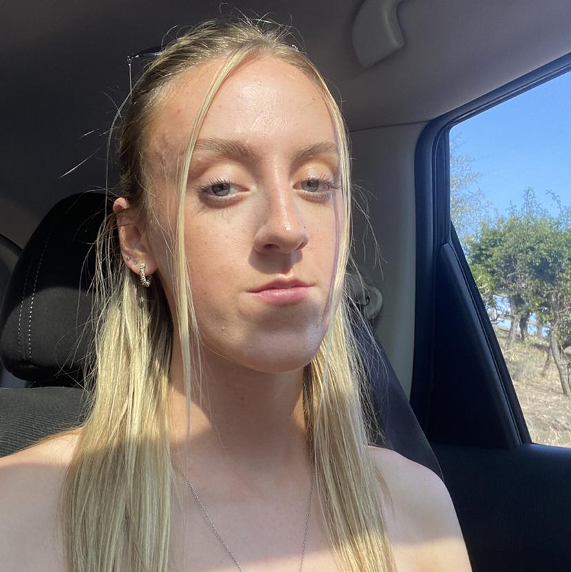 Siarkan Anna Doble |Lemon8