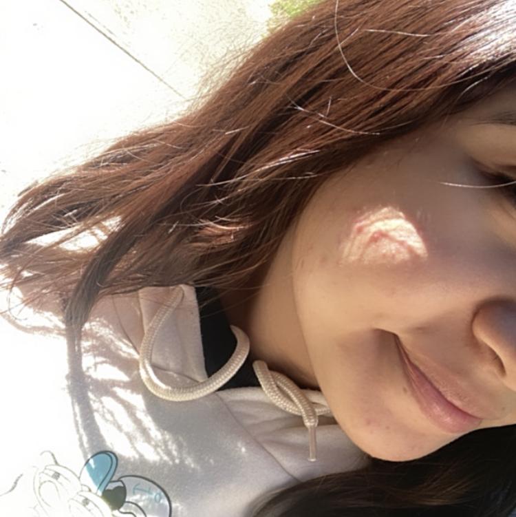 โพสต์ ของ Allison |Lemon8