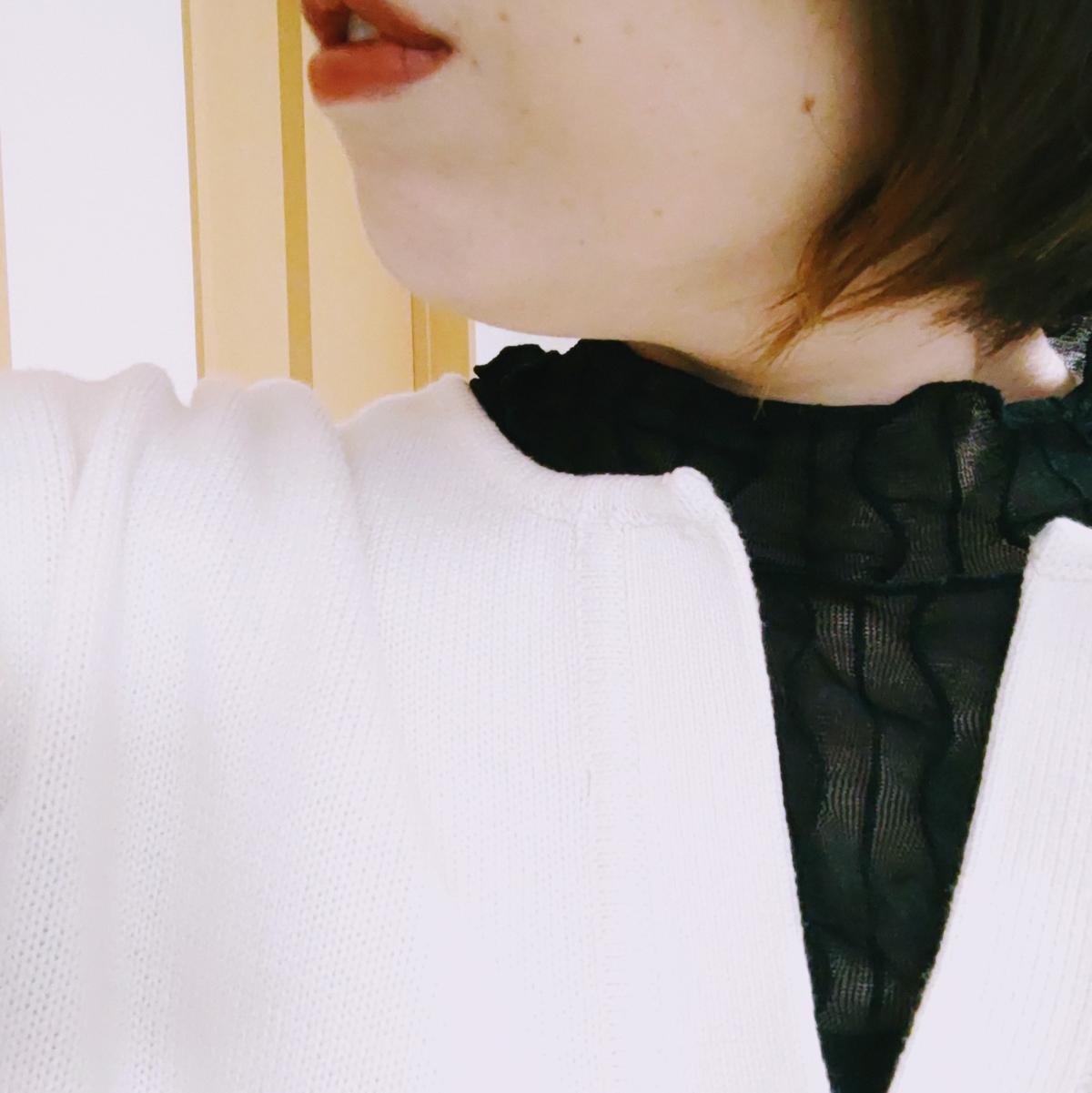 โพสต์ ของ chiro.*♡|Lemon8