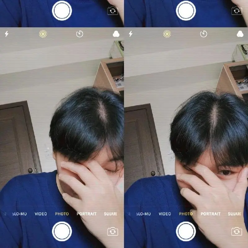 โพสต์ ของ Mild|Lemon8